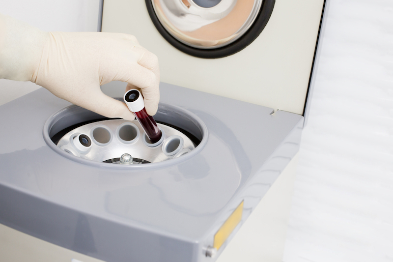 Autolog plasma i behandlingen av rygg- eller ledont - EuroPainClinics